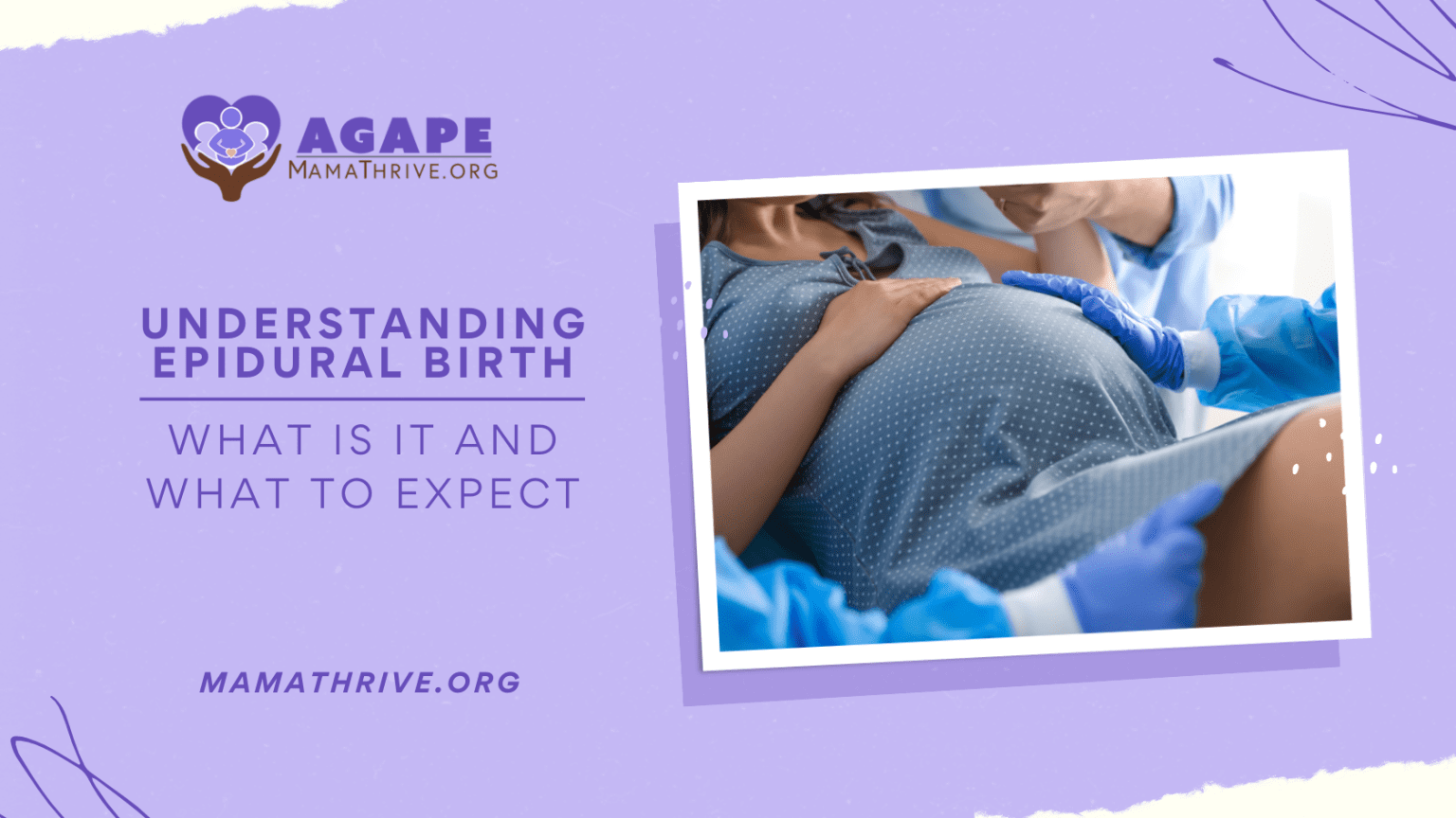 Understanding Epidural Birth: What is it and What to Expect